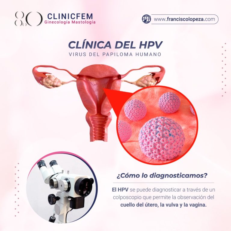 Clínica del VPH y Colposcopía | Clinicfem